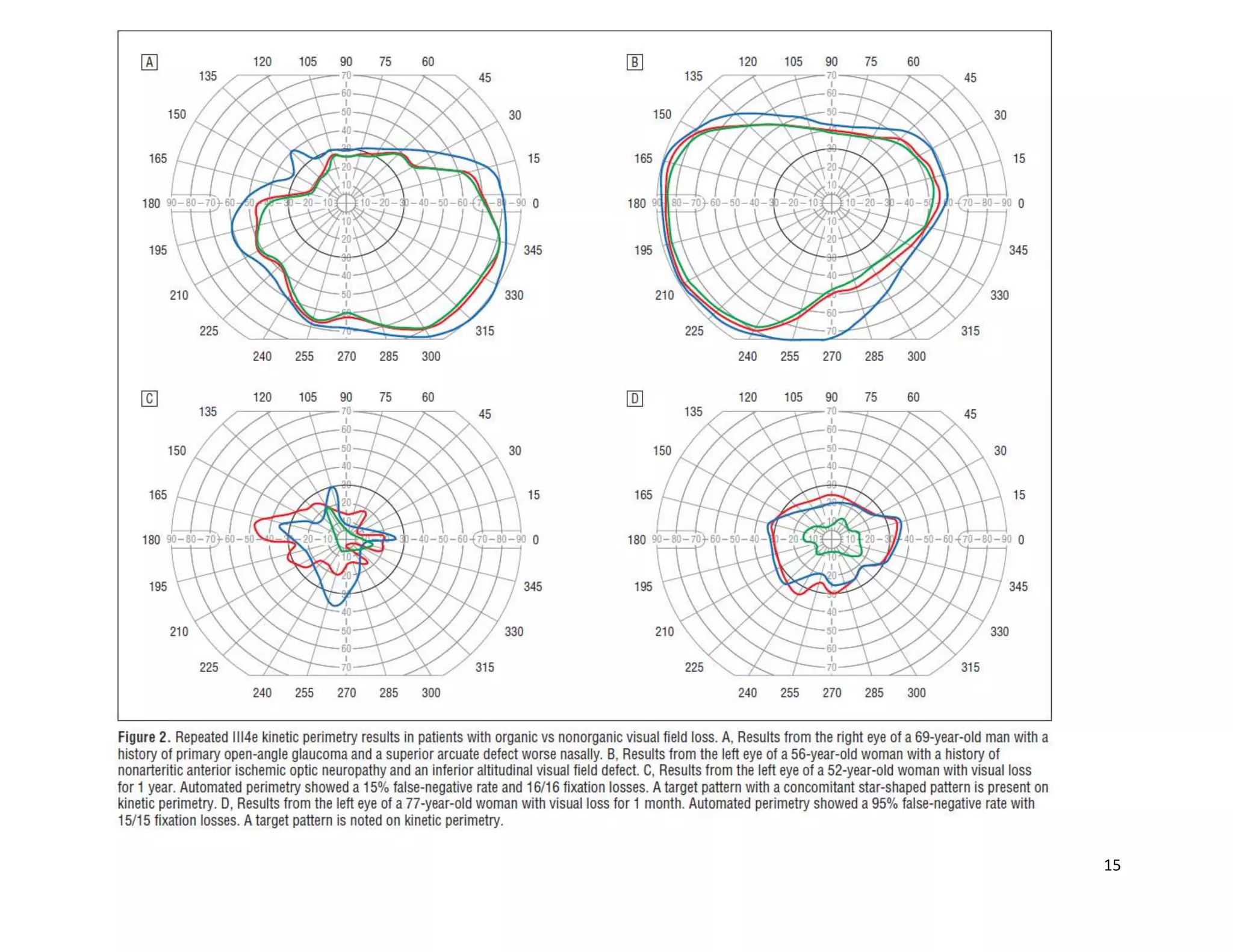 Functional vision loss table 2 | DOCX