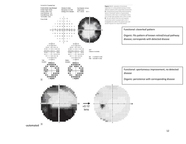 Functional vision loss table 2 | PPT