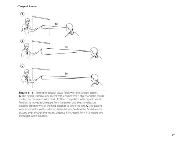 Functional vision loss table 2 | DOCX
