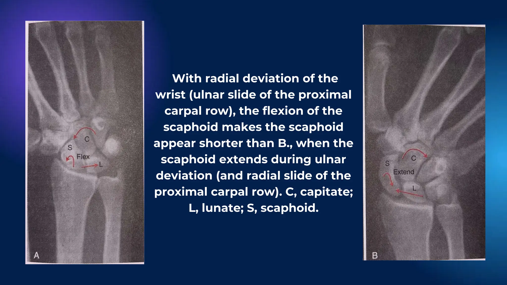 Function of wrist complex.pptx