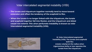Function of wrist complex.pptx
