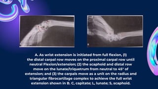 Function of wrist complex.pptx