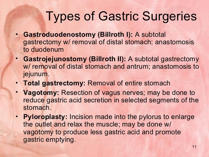 Gastroduodenostomy Procedure