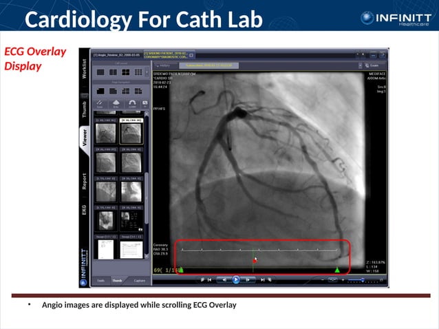 Functions of INFINITT Cardiology presentation | PPT