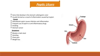 Functions of Stomach and GFT.pptx Gastric Function test | PPTX