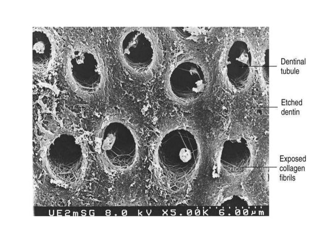 Fundamental concepts of enamel and dentin adhesion | PPTX