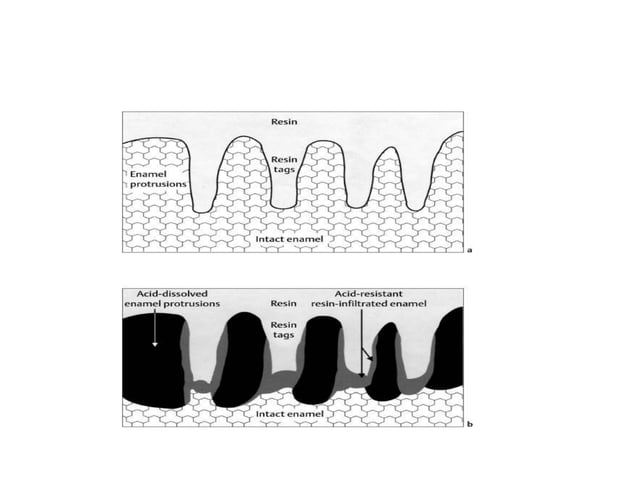 Fundamental Concepts Of Enamel And Dentin Adhesion Ppt