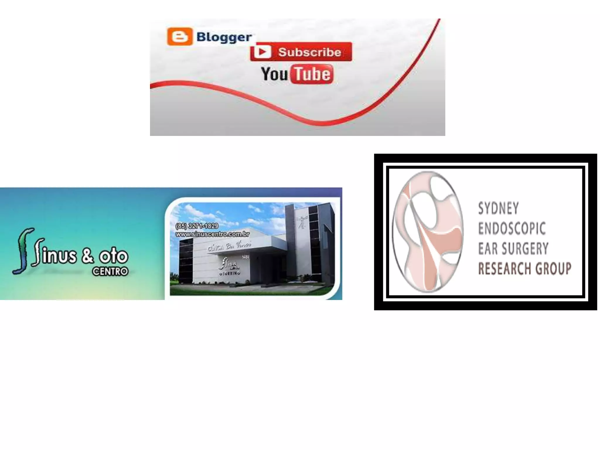 Fundamental of endoscopic middle ear anatomy | PPTX