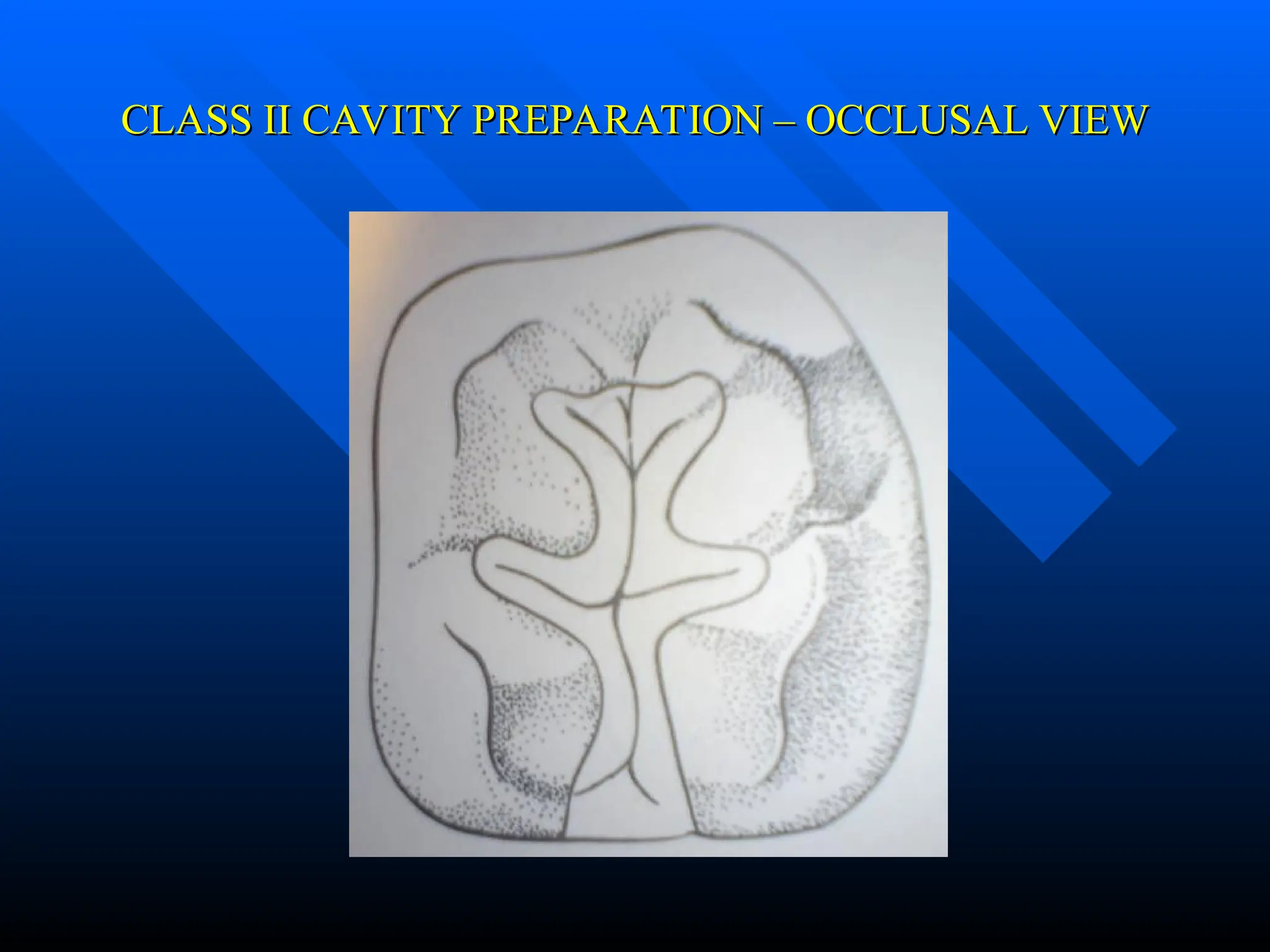Fundamentals-of-cavity-preparation endodontics | PPT