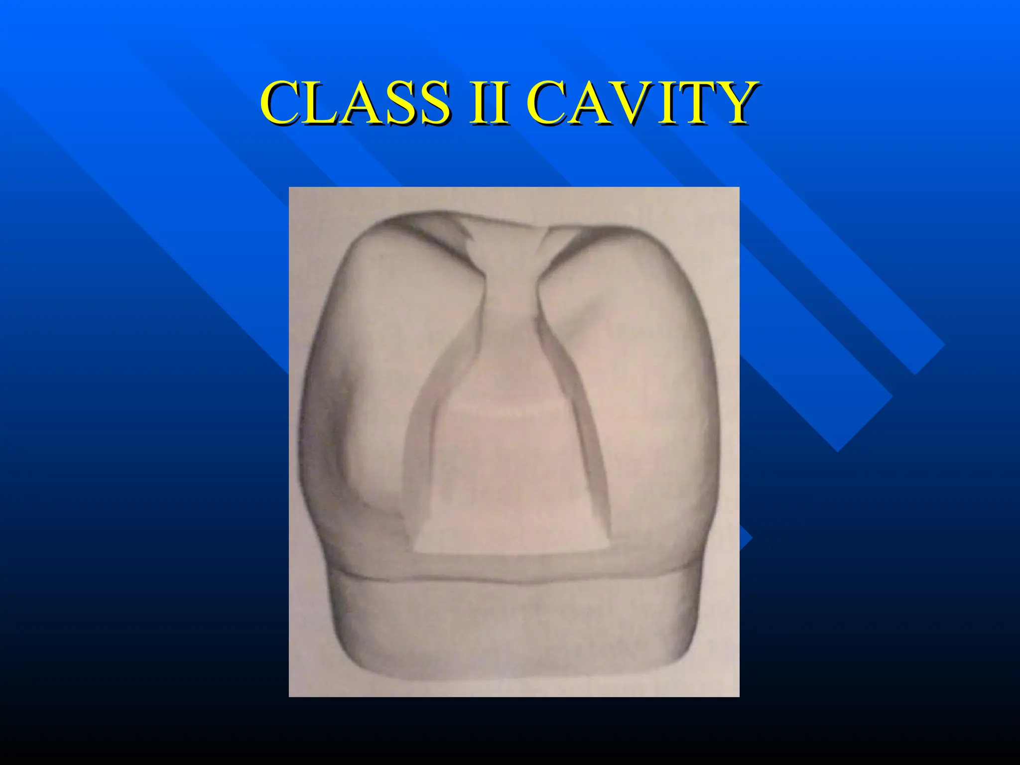 Fundamentals-of-cavity-preparation 1.ppt