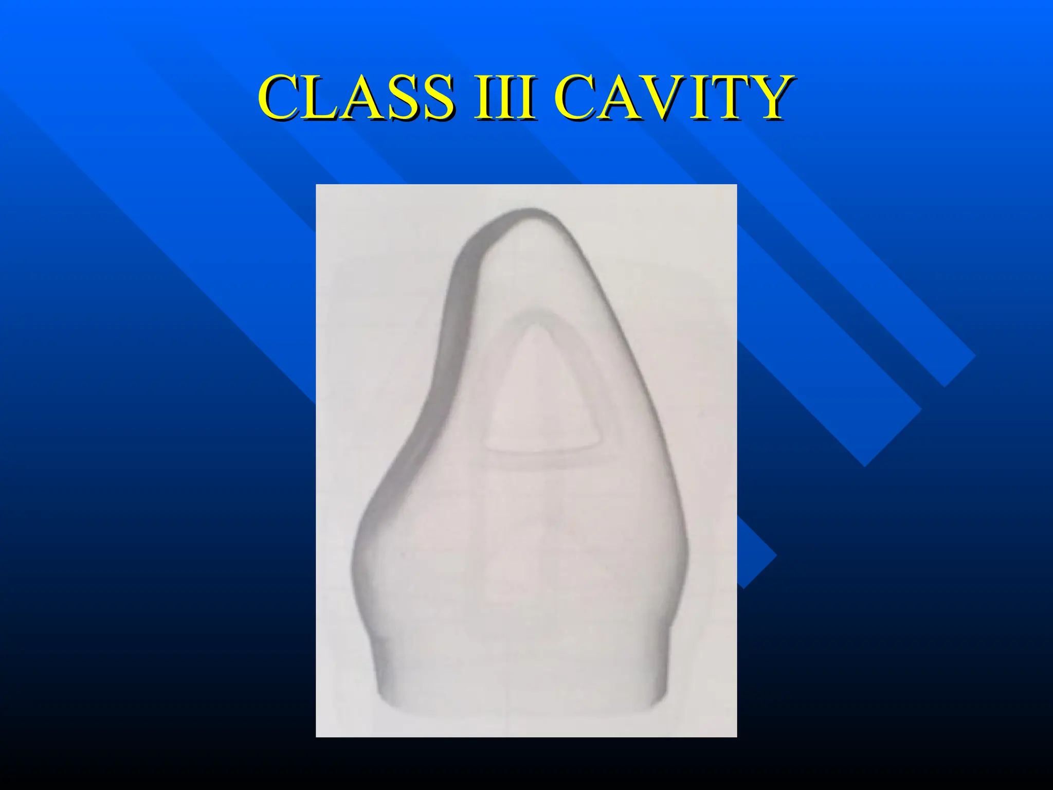 Fundamentals-of-cavity-preparation 1.ppt
