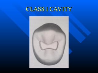 Fundamentals-of-cavity-preparation 1.ppt