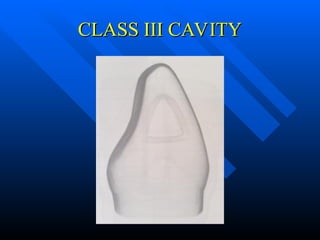 Fundamentals-of-cavity-preparation 1.ppt