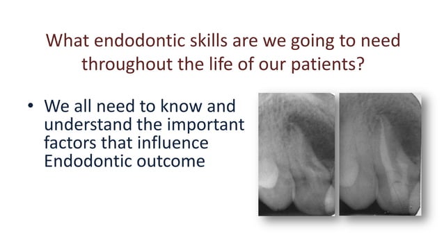 Fundamentals-of-Endodontics-lecture-20141.pdf