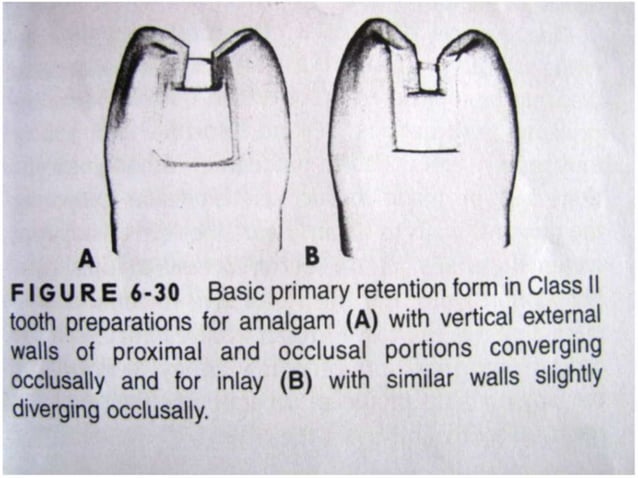 Fundamentals in tooth preparation . | PPTX