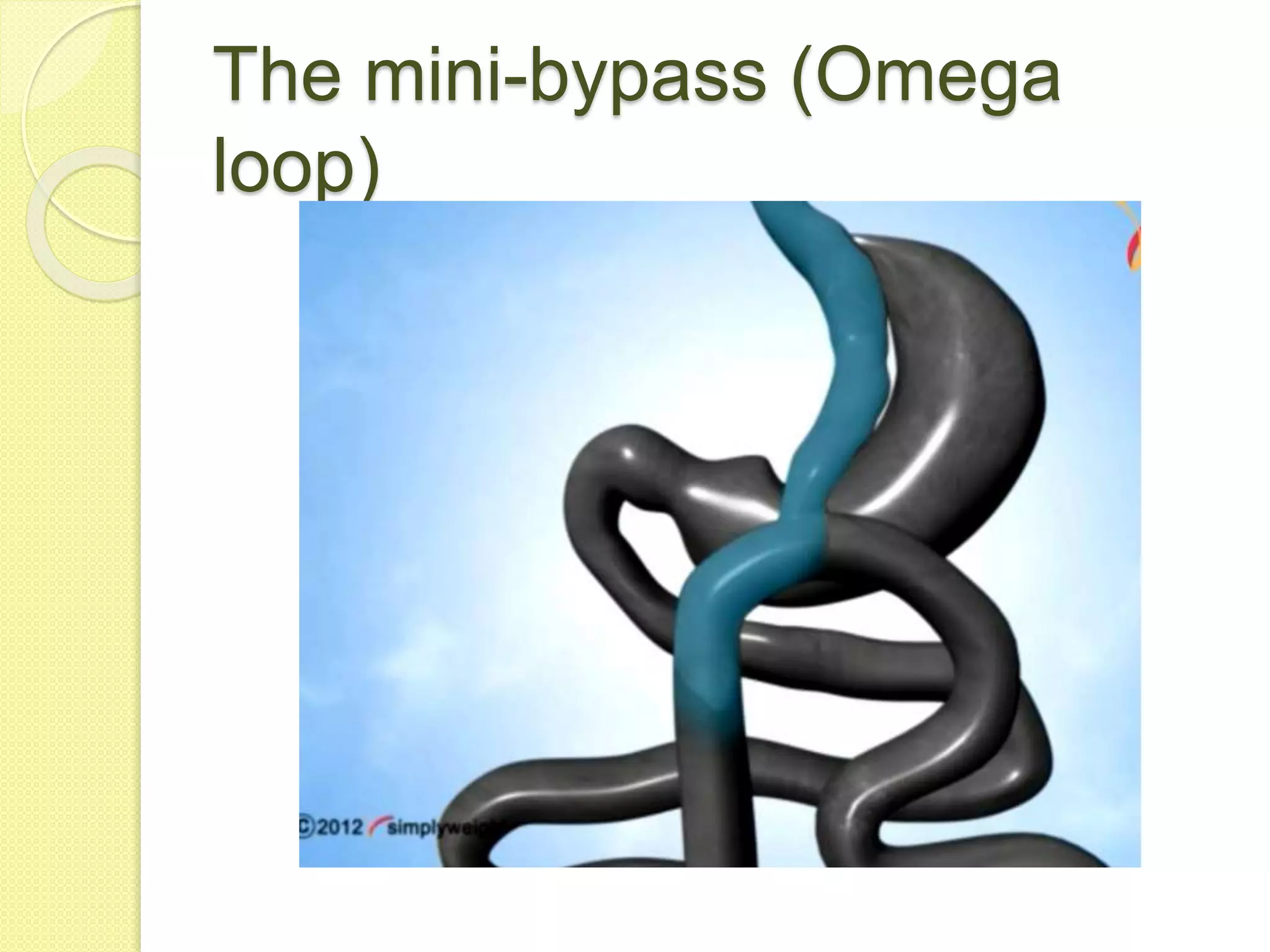 Fundamentals of bariatric and metabolic surgery | PPTX