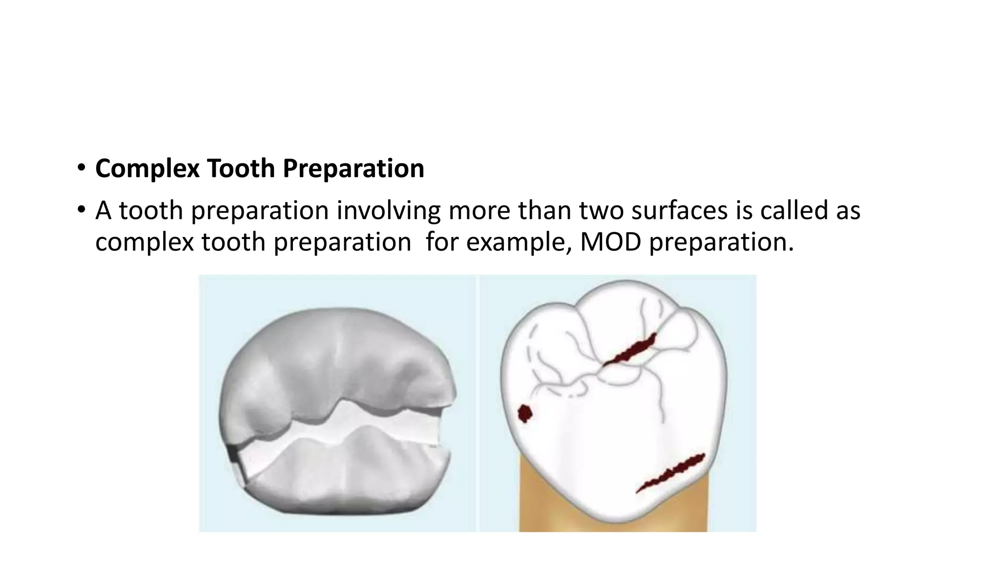 Fundamentals of cavity perp.pptx