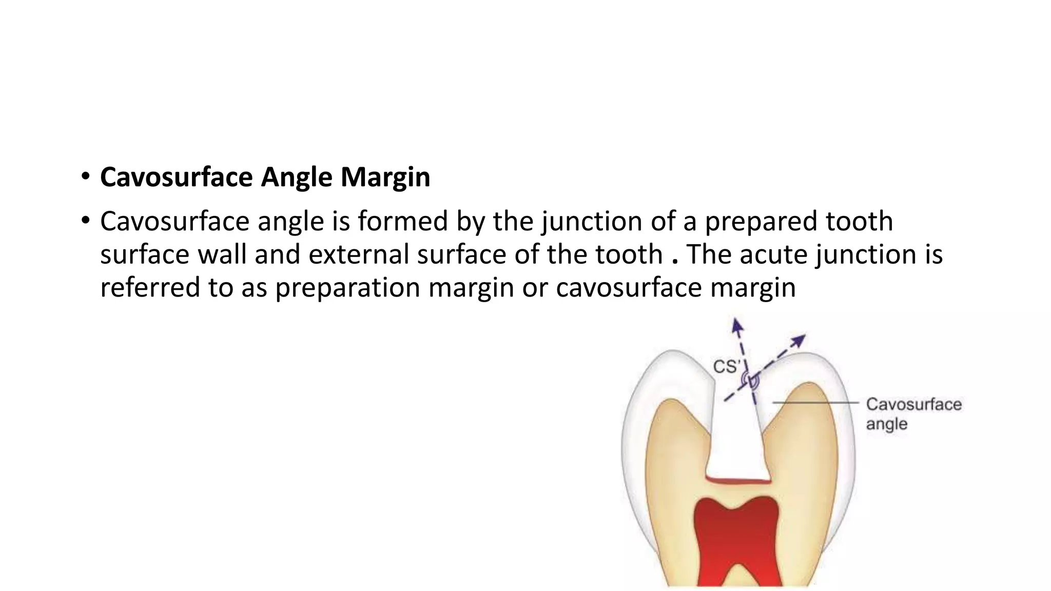 Fundamentals of cavity perp.pptx