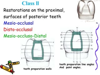 Fundamentals of tooth preparation - operative dentistry | PPT