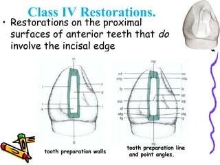 Fundamentals of tooth preparation - operative dentistry | PPT