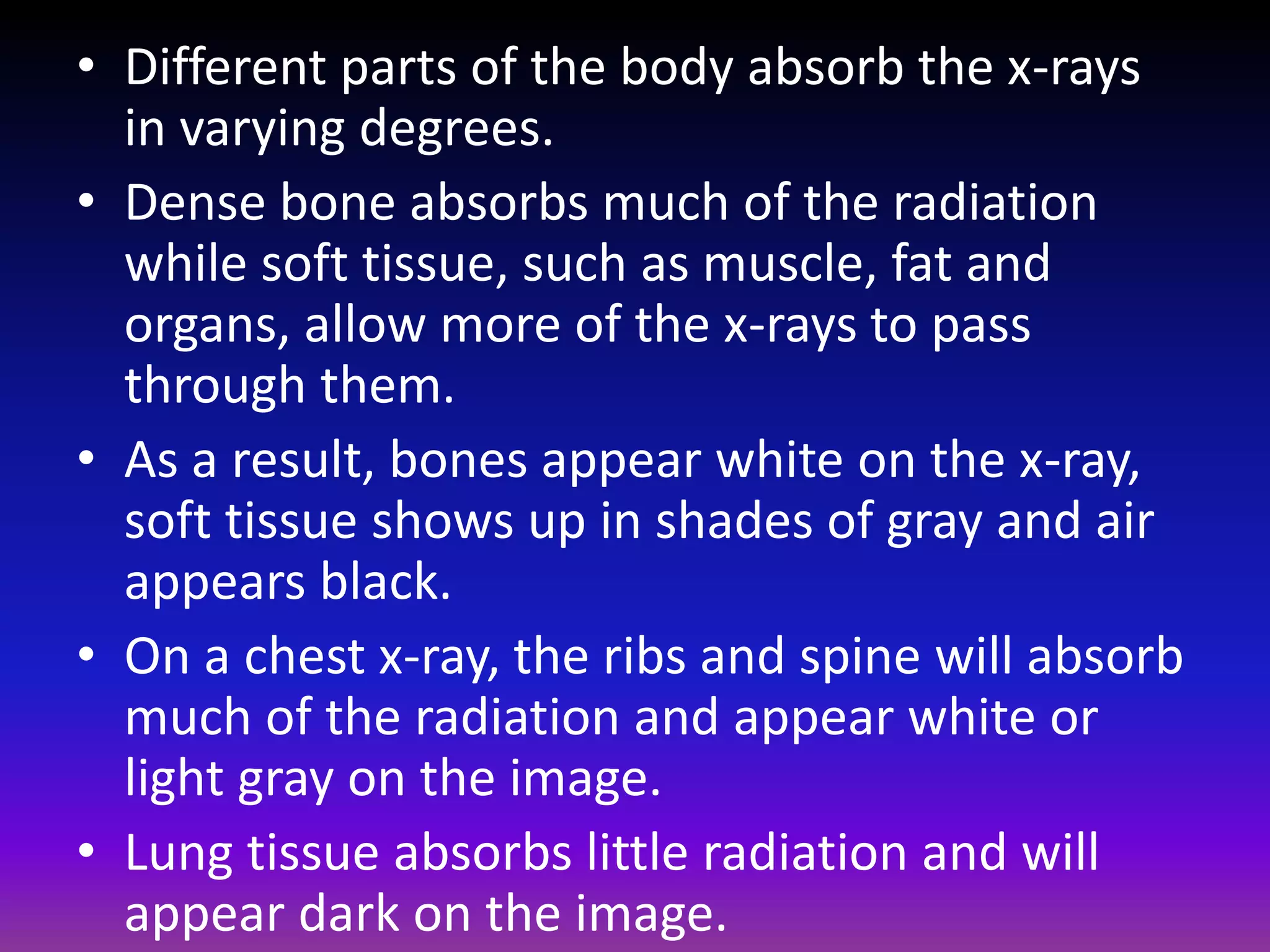 Fundamentals of chest radiology | PDF