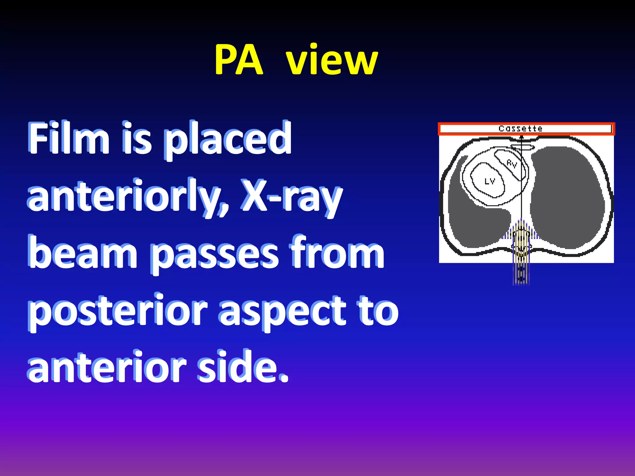 Fundamentals of chest radiology | PDF