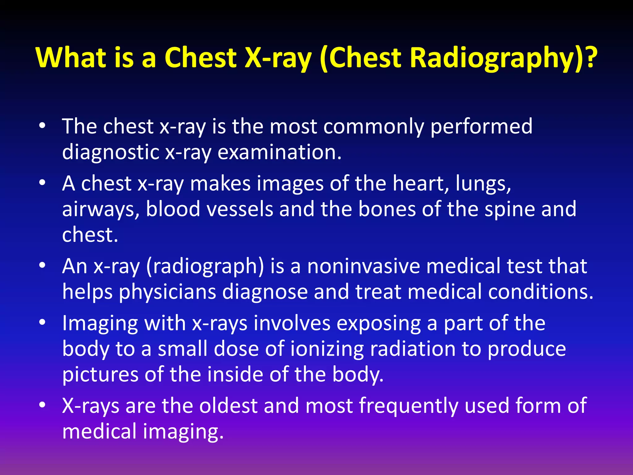 Fundamentals of chest radiology | PDF