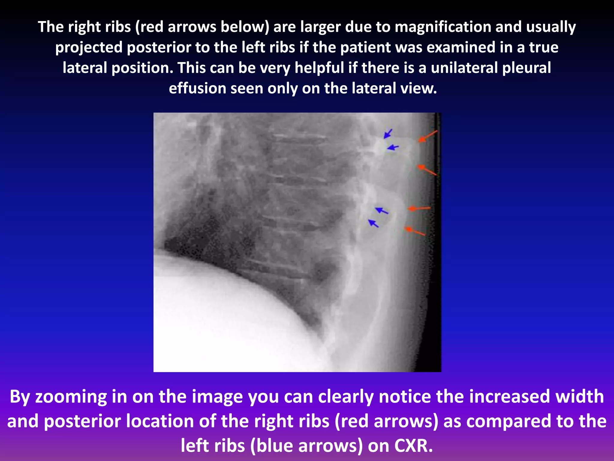 Fundamentals of chest radiology | PDF