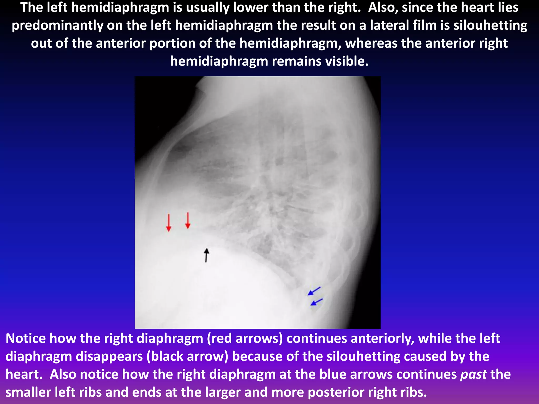 Fundamentals of chest radiology | PDF