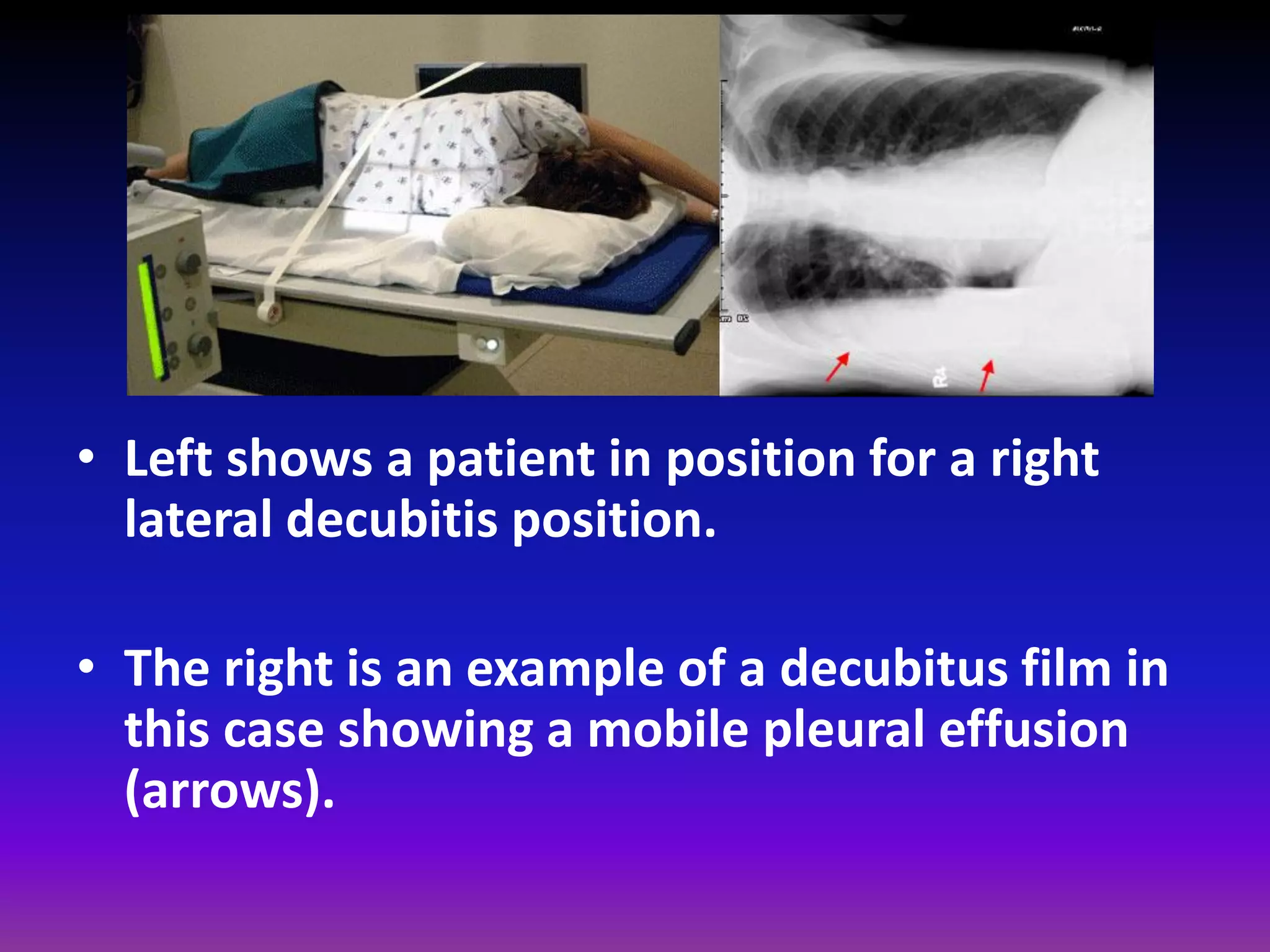 Fundamentals of chest radiology | PDF