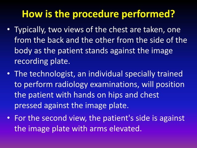 Fundamentals of chest radiology | PDF