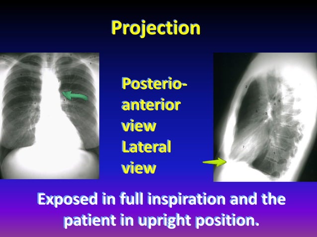 Fundamentals of chest radiology | PDF