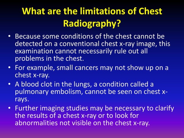Fundamentals of chest radiology | PDF