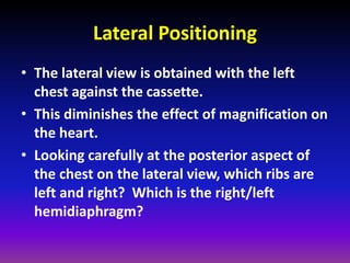 Fundamentals of chest radiology | PDF