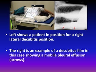 Fundamentals of chest radiology | PDF