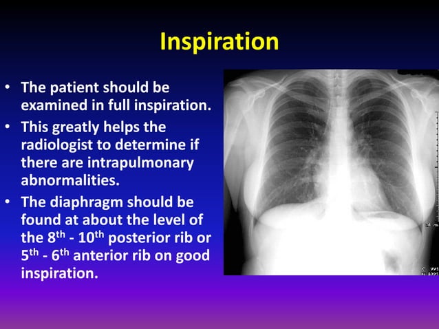 Fundamentals of chest radiology | PDF