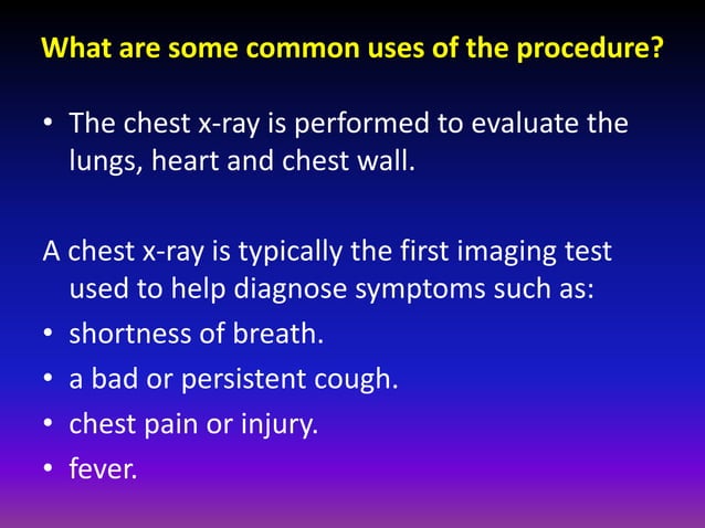 Fundamentals of chest radiology | PDF
