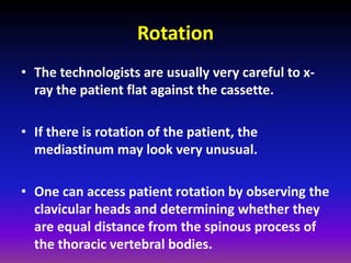 Fundamentals of chest radiology | PDF