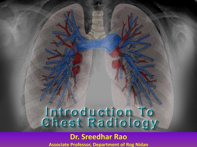 Fundamentals of chest radiology | PPT