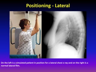 Fundamentals of chest radiology | PPT