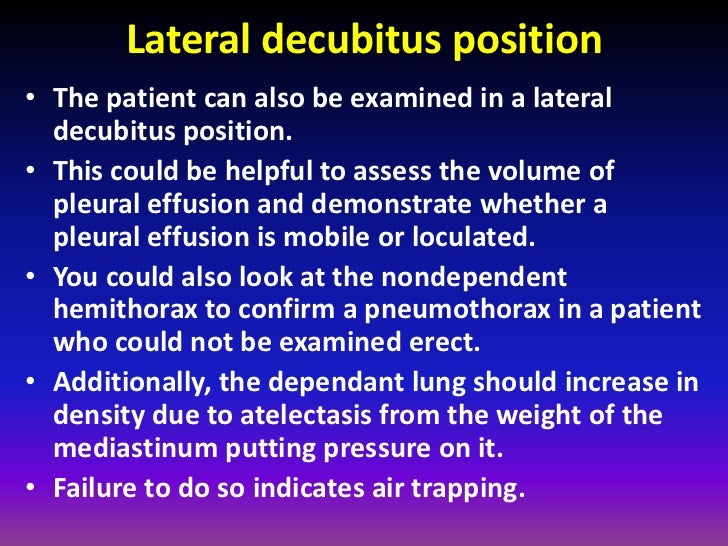 Fundamentals of chest radiology
