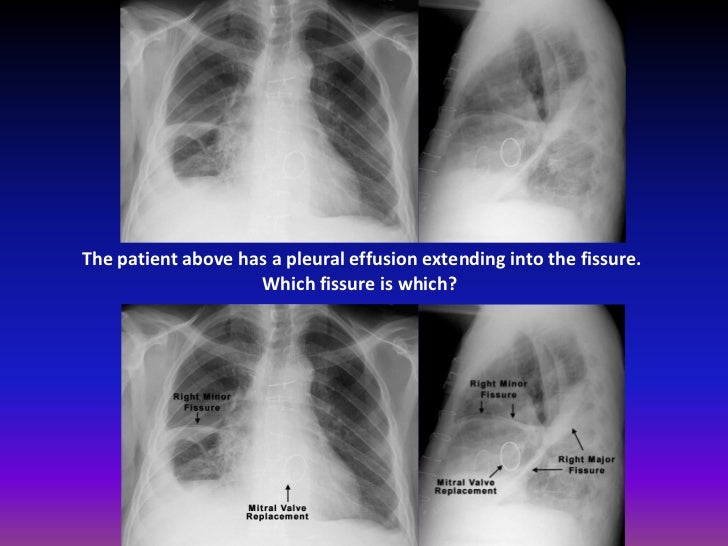 Fundamentals of chest radiology