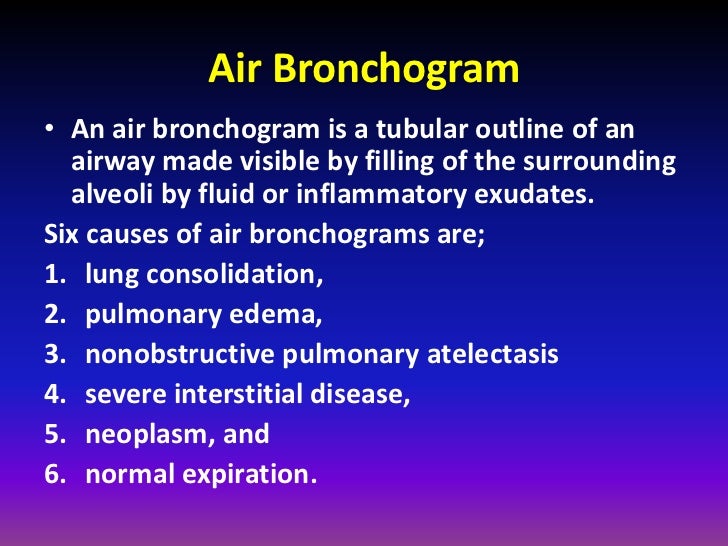 Fundamentals of chest radiology