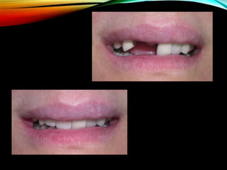 fundamentals of dental technology.pptx