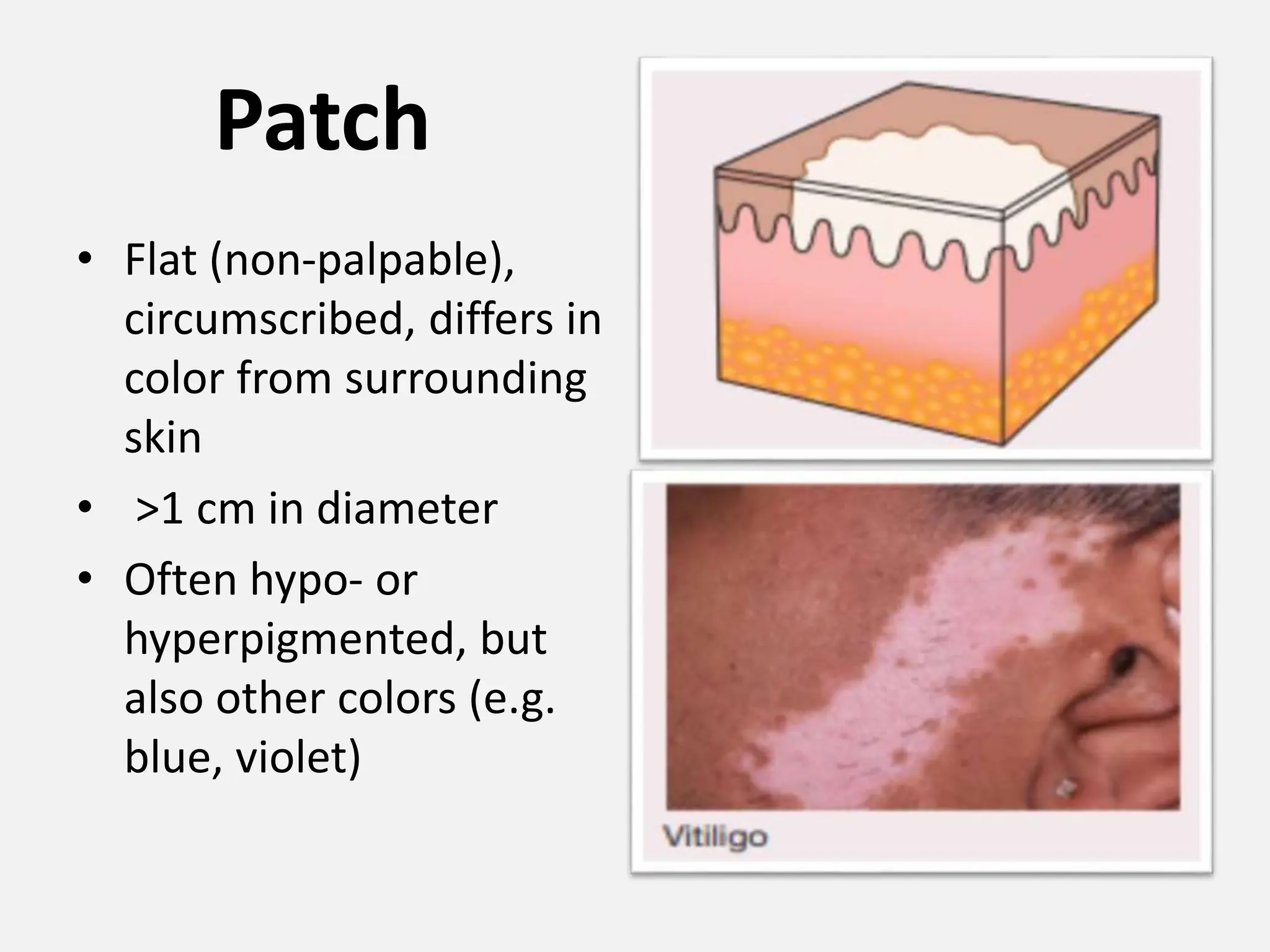 fundamentals of dermatology HO final.pptx | Skin and Dermatology ...