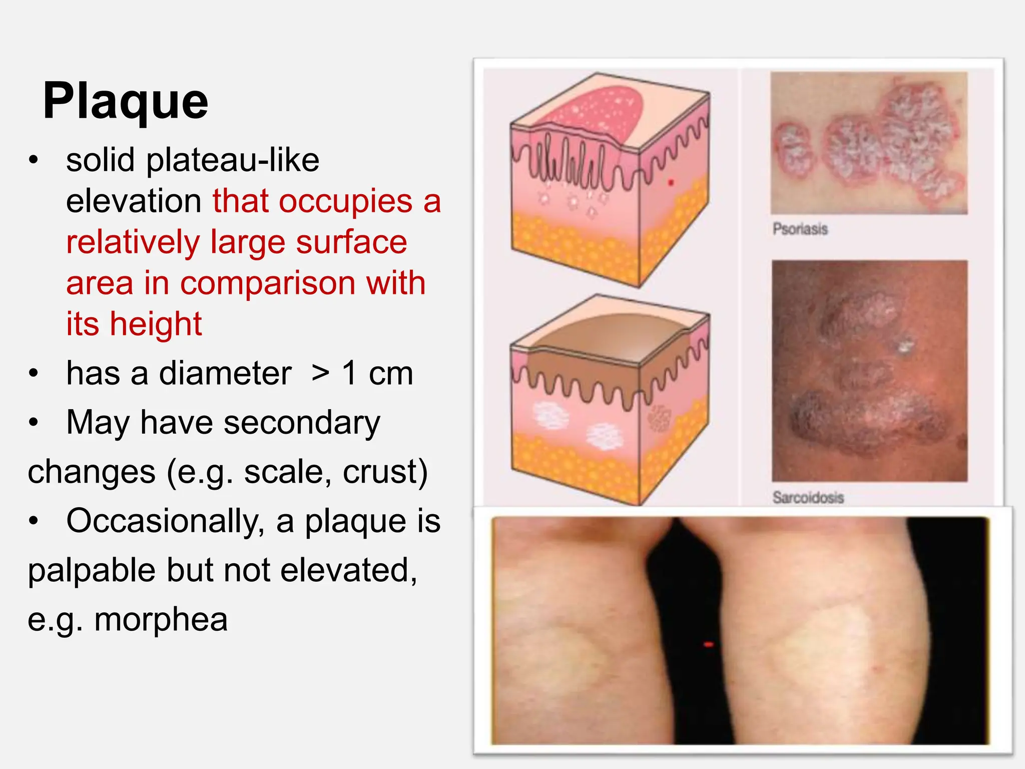 fundamentals of dermatology HO final.pptx | Skin and Dermatology ...