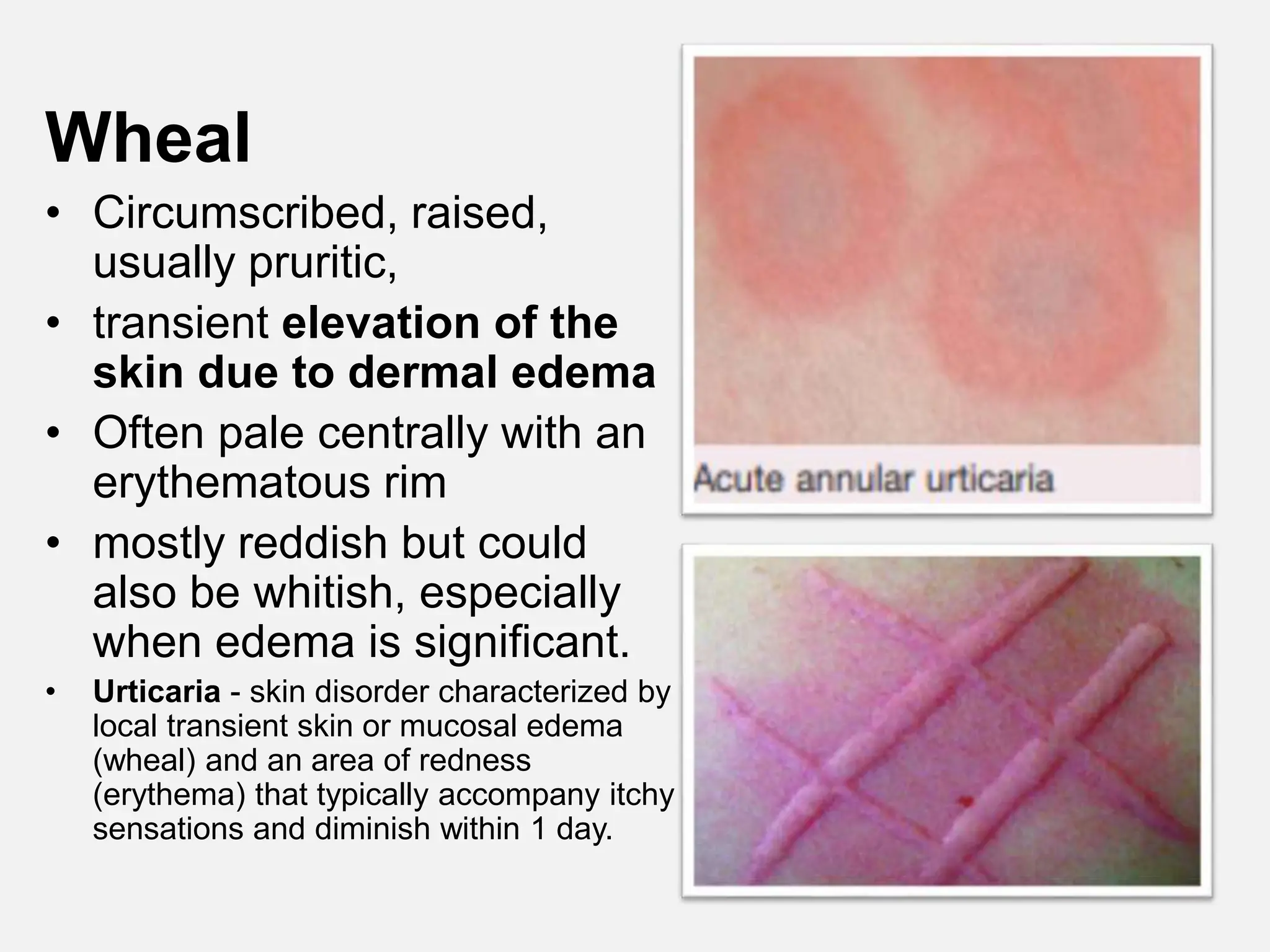 fundamentals of dermatology HO final.pptx | Skin and Dermatology ...