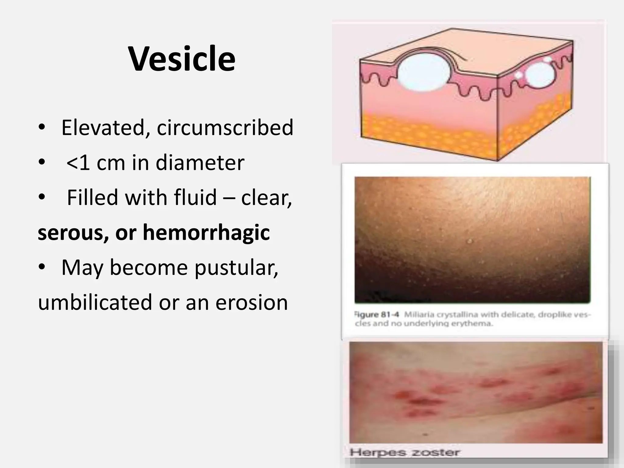 fundamentals of dermatology HO final.pptx | Skin and Dermatology ...
