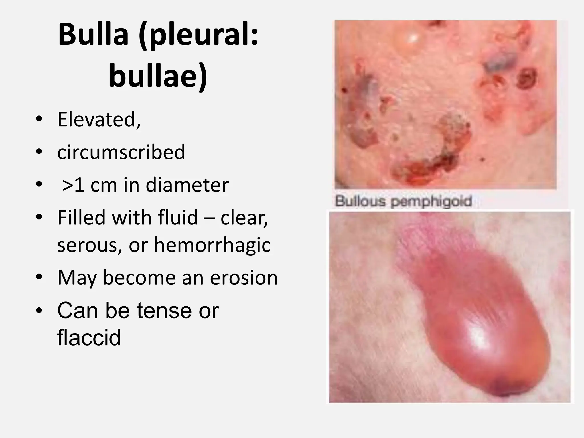fundamentals of dermatology HO final.pptx | Skin and Dermatology ...