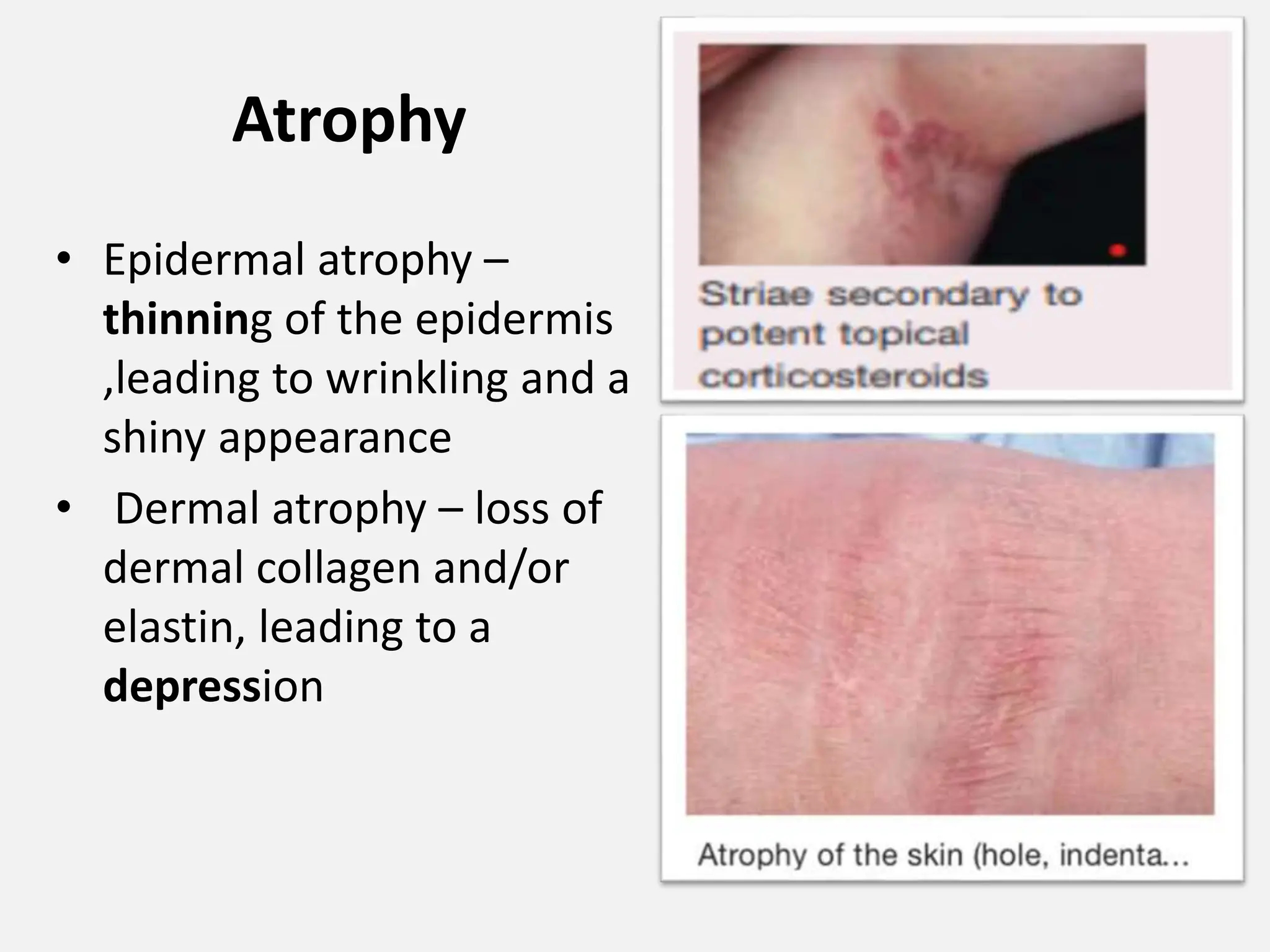 fundamentals of dermatology HO final.pptx | Skin and Dermatology ...